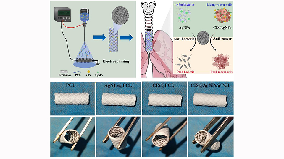 Anti-cancer, antibacterial airway stent | Scilight | AIP Publishing