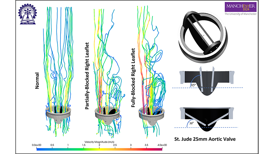 Modeling artificial heart valves to enhance performance | Scilight ...