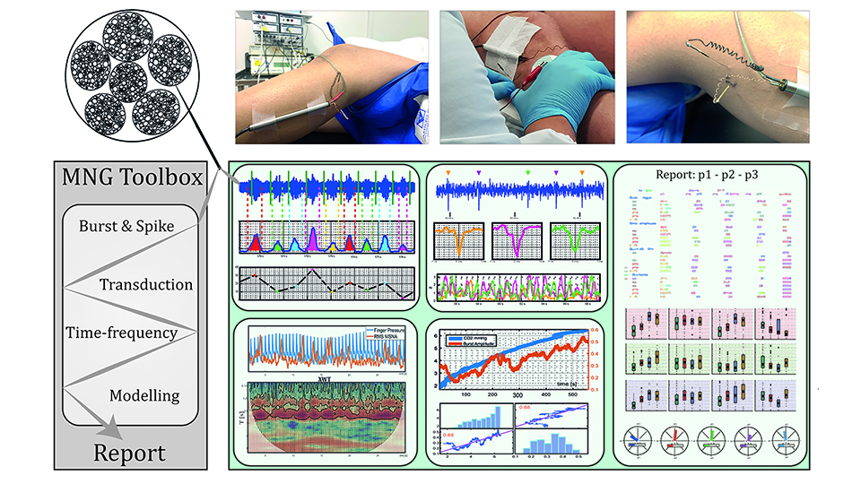 Computational toolbox makes microneurography analysis techniques widely available | Scilight ...