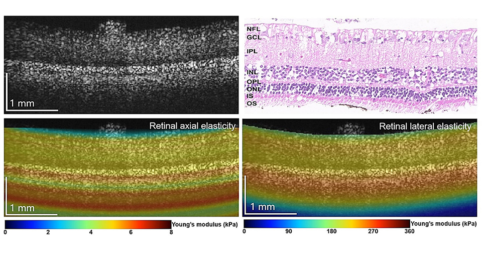 Expanding retinal elasticity measurements into multiple directions ...