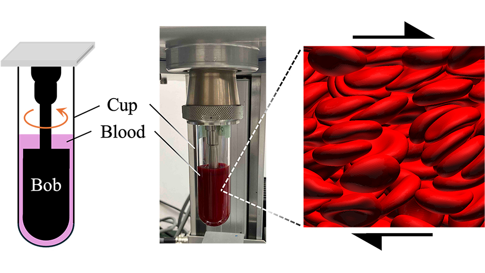 Key blood disease indicator can be estimated with rheological blood ...