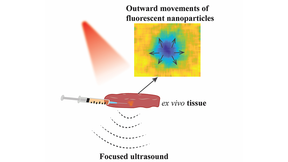 Squeezing tissue with ultrasound for drug delivery | Scilight | AIP ...