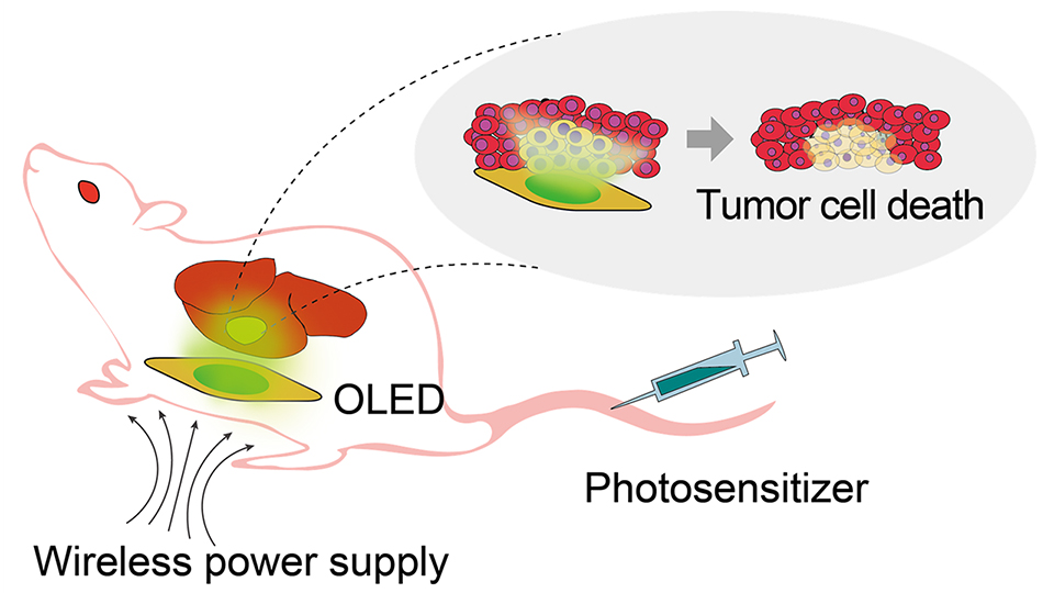 Wireless OLED metronomic photodynamic device kills deep organ tumor ...