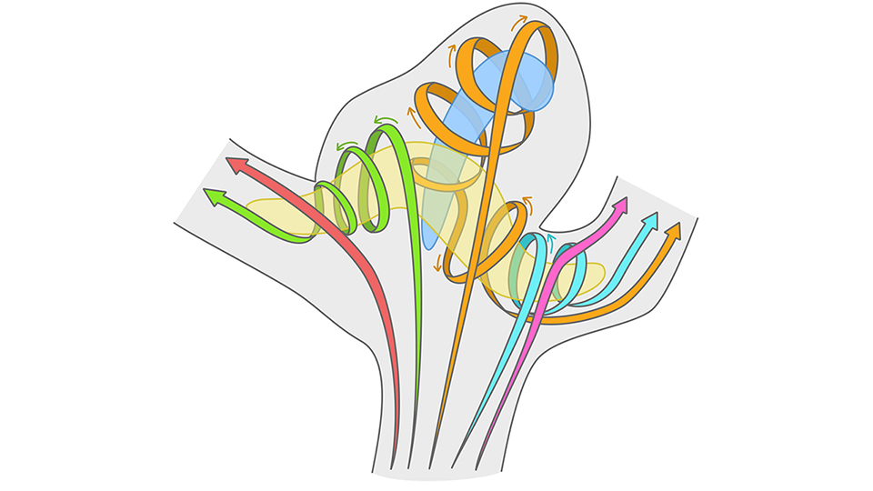 Direct numerical simulations illustrate aberrant blood flow ...