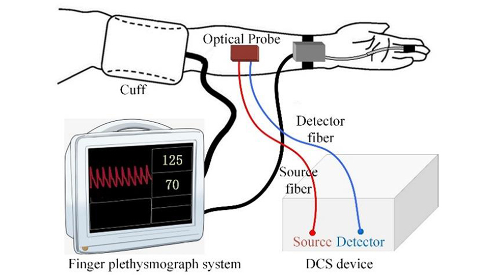 Noninvasive continuous blood pressure monitoring using infrared ...