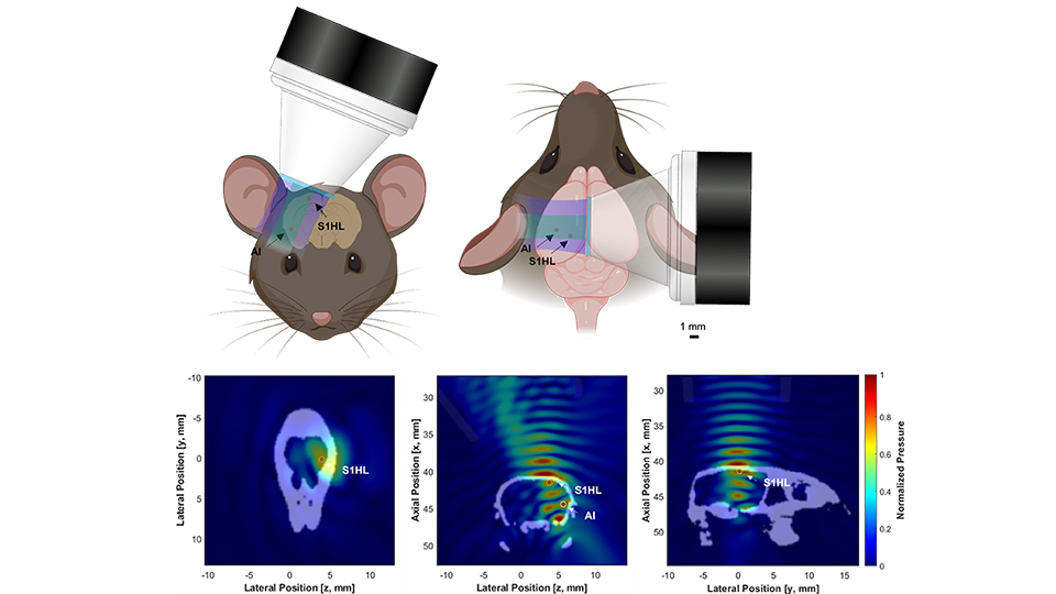 Chronic pain management in aged mice via transcranial focused ...