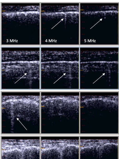 Lung Ultrasound | AIP Publishing