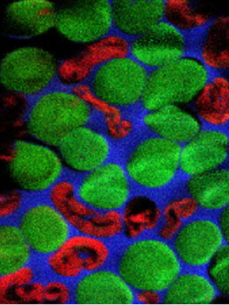 Collections | AVS: Science & Technology of Materials Interfaces and ...